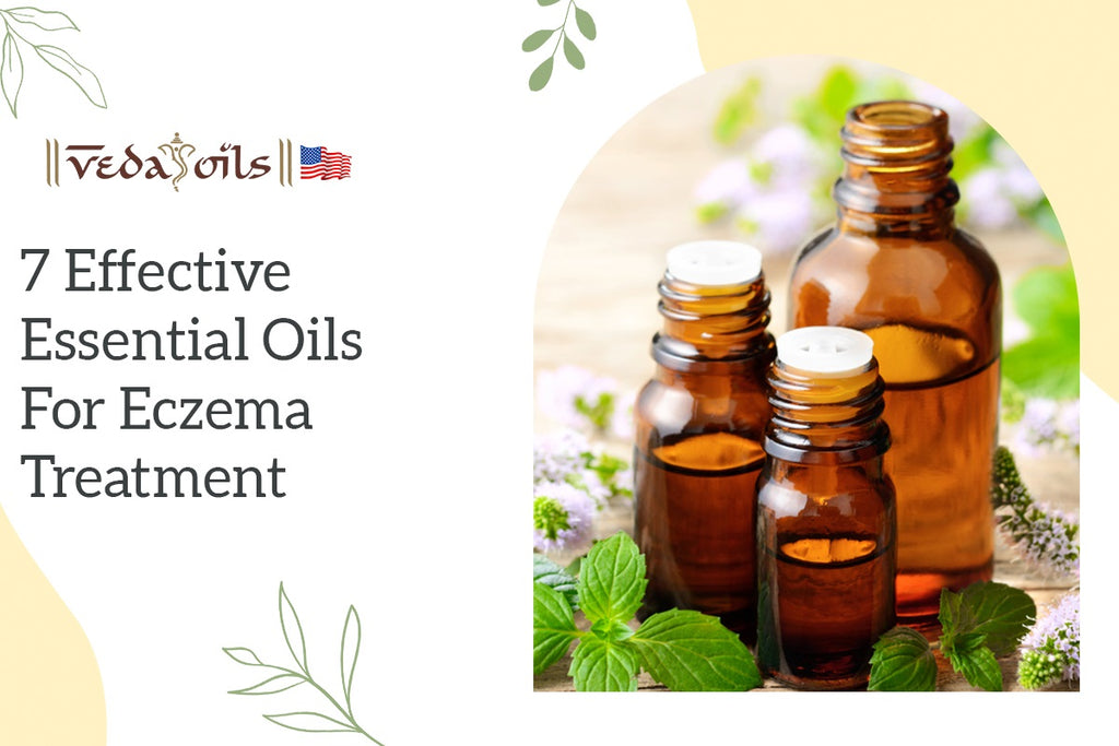 7 Most Effective Essential Oils for Eczema Treatment: How to Use Them – VedaOils USA