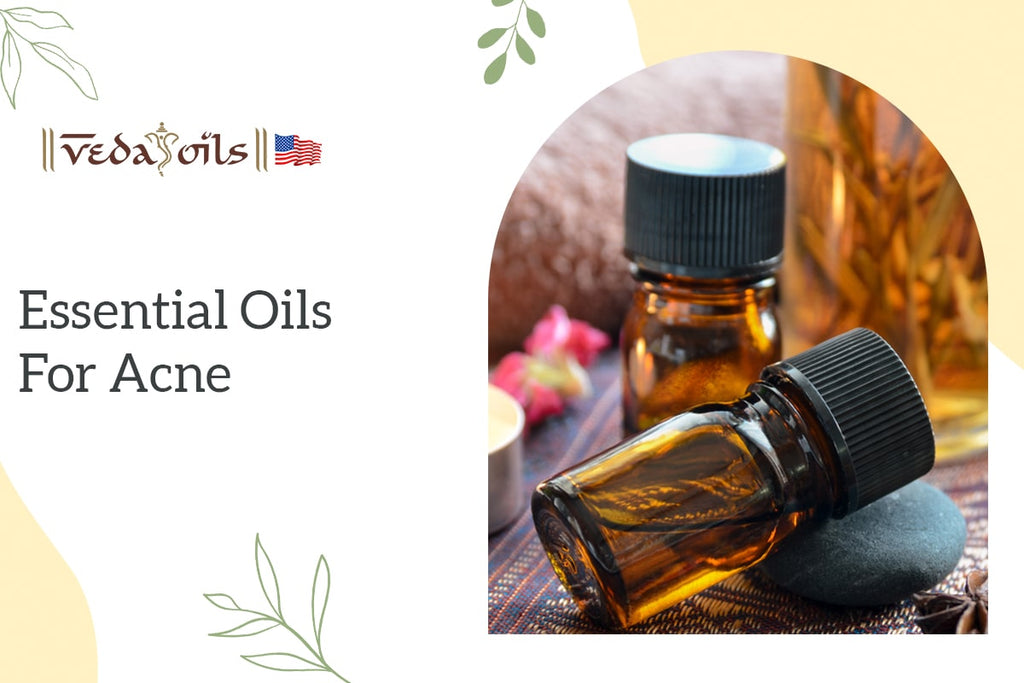 7 Best Essential Oils for Acne : How to Use Them for Pimples Treatment – VedaOils USA